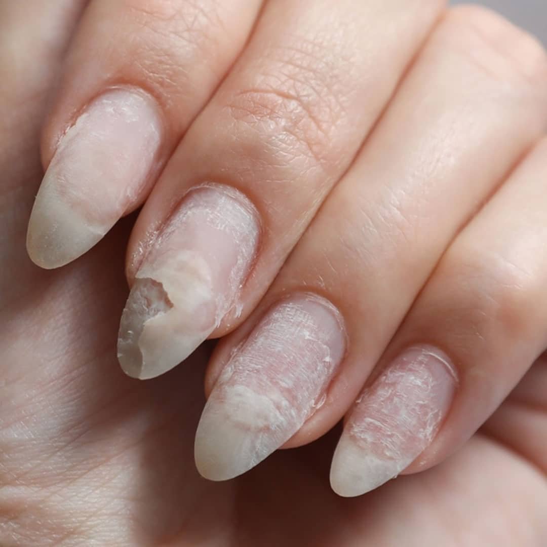 Nail Conditions - TKMD